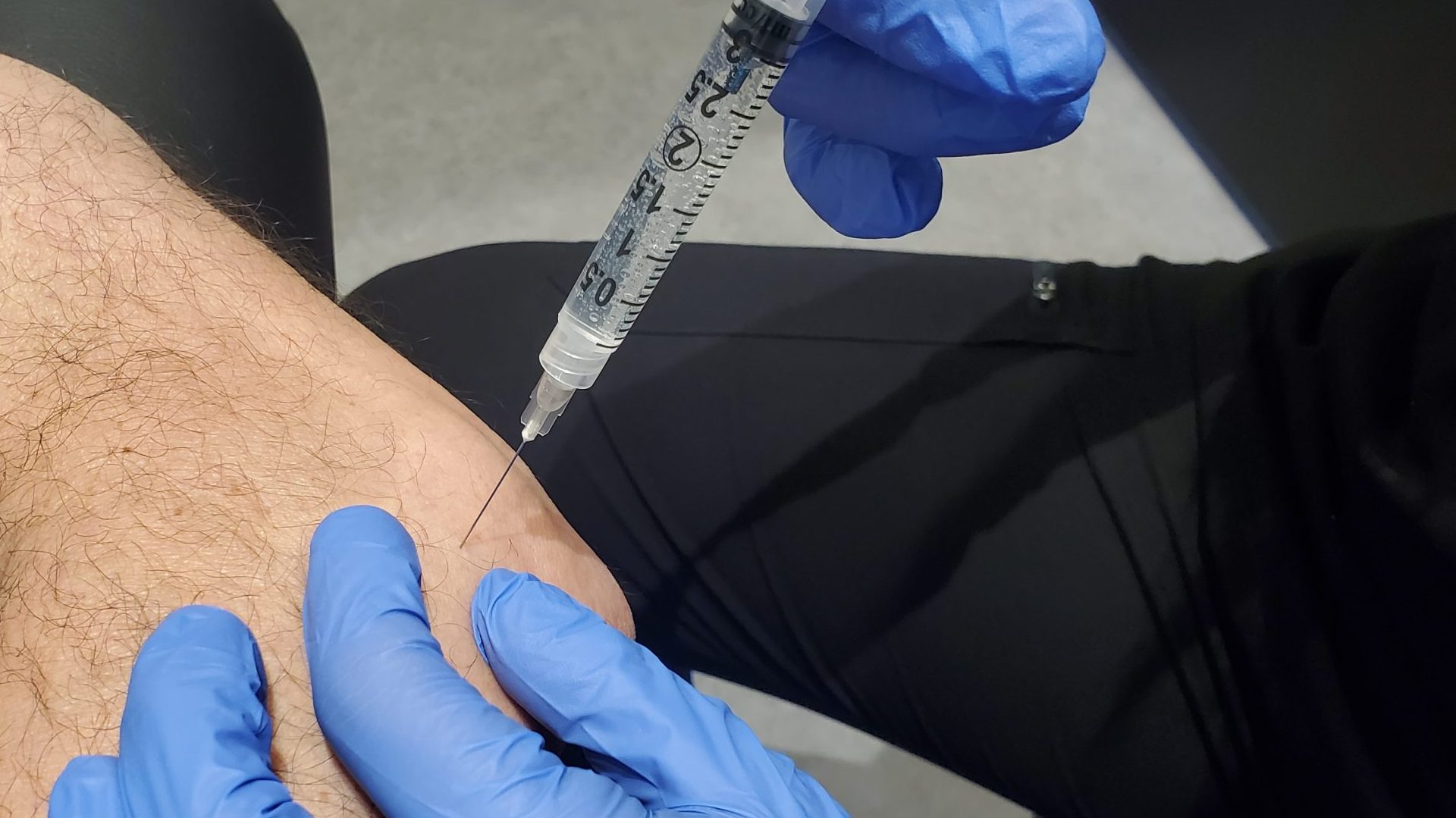 Procedures – Avery Neuro Med